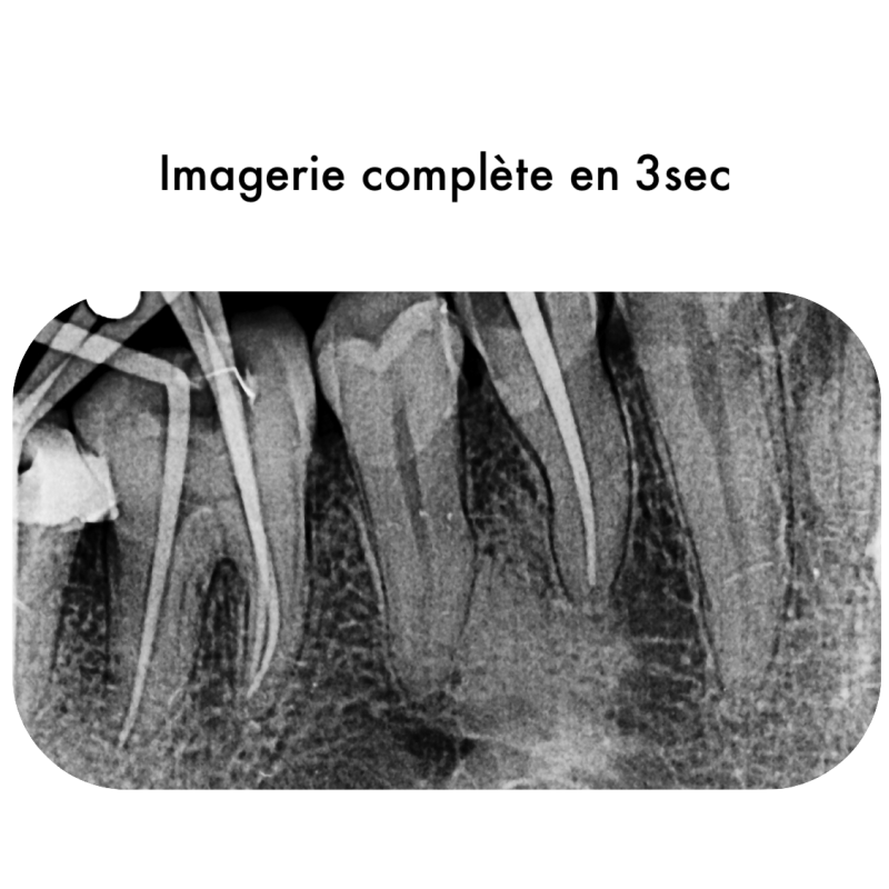 Capteur radio iSensor H2 RVG X-ray - Woodpecker